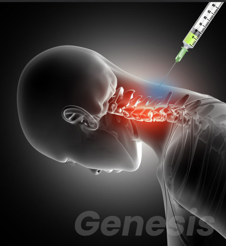 Stellate Ganglion Block – Genesis